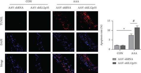Il12p35 Silencing Exacerbates Smc Apoptosis After Ang Ii Infusion A