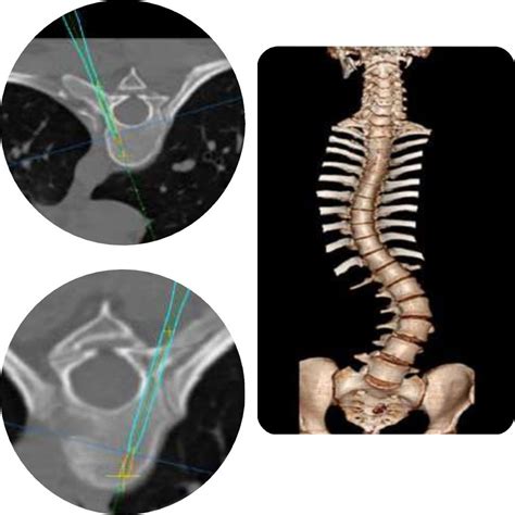Easynav 2 0 Spine Navigation System Top Spinal Surgery Navigation System From Hrs Navigation