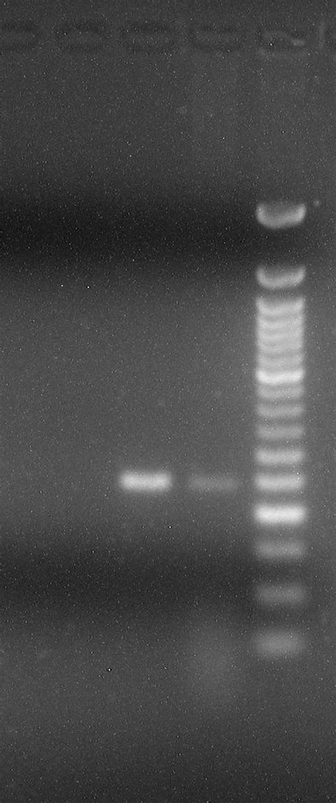 Electrophoregram of PCR products with type specific primers to НА a Download Scientific