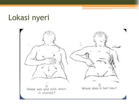 Apendisitis Akut And Kronik Pptx
