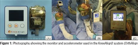 Figure 1 From Using Accelerometer Based Portable Navigation To Perform