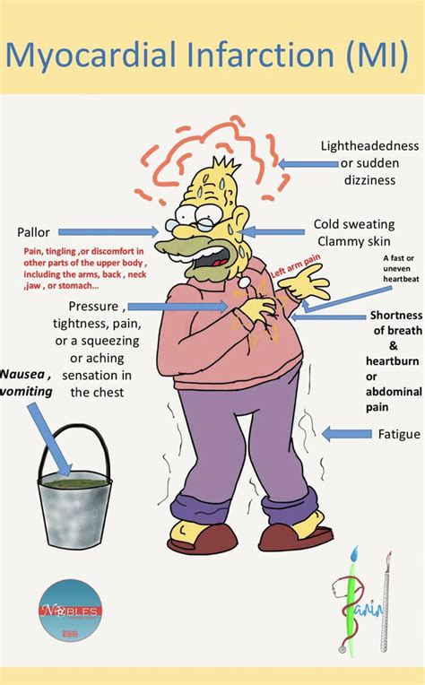 Myocardial Infarction Animation