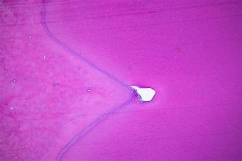 Showing Light Micrograph Of The Sublingual Gland Oesophagus Human And