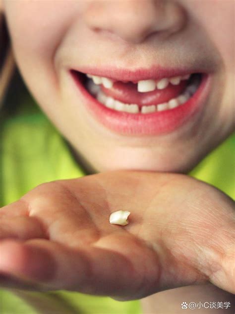 孩子换牙阶段需要注意什么？