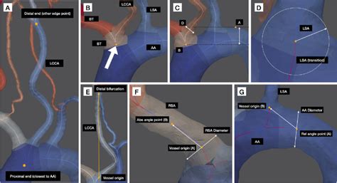 Sample Of Automatically Extracted Features A Oriented Vascular