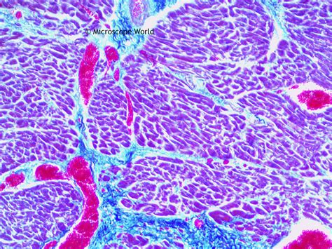 Cardiac Muscle