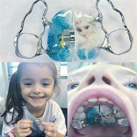 Teeth Humor Dental Humor Dental Hygiene Dental Care Dentist Logo