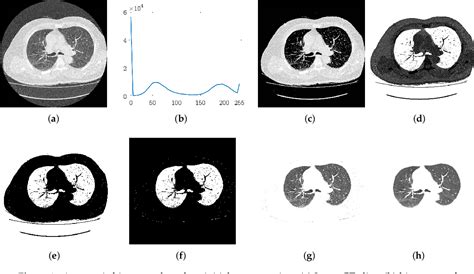 Figure 1 From Lung Nodule Detection In Ct Images Using Statistical And Shape Based Features