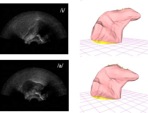Development Of A 3d Tongue Motion Visualization Platform Based On Ultrasound Image Sequences