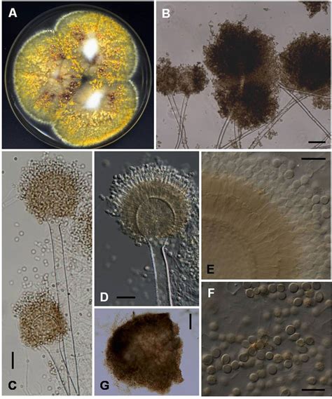 Aspergillus Nomiae Atlas Of Clinical Fungi