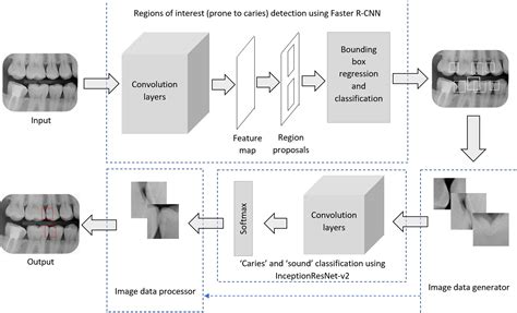 Evaluation Of A Deep Learning System For Automatic Detection Of Proximal Surface Dental Caries