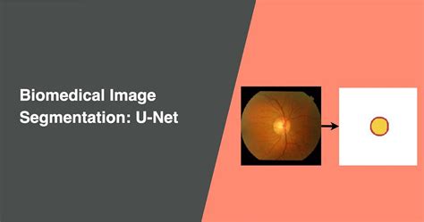 biomedical image segmentation u net by jingles hong jing towards