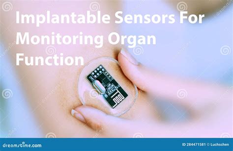 Implantable Sensors For Monitoring Organ Function Implantable Electron