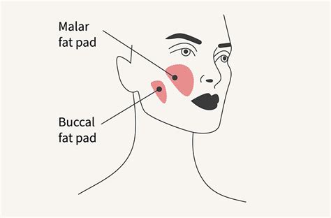 Have You Heard Of Buccal Fat Pad Removal Surgery