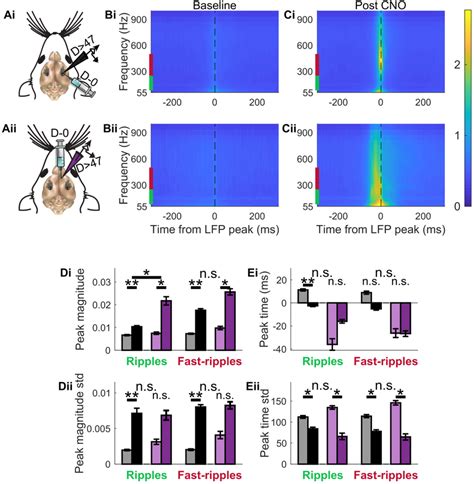 Wavelet Analysis Of Spontaneous Focus Epileptiform Events Download Scientific Diagram