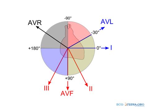 Qrs Axis Ecgpedia