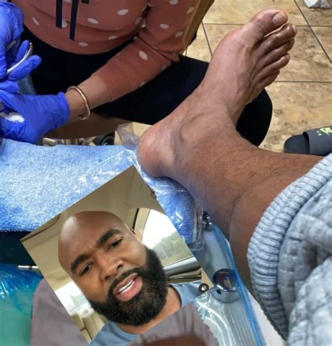 Michael Anthonys Feet