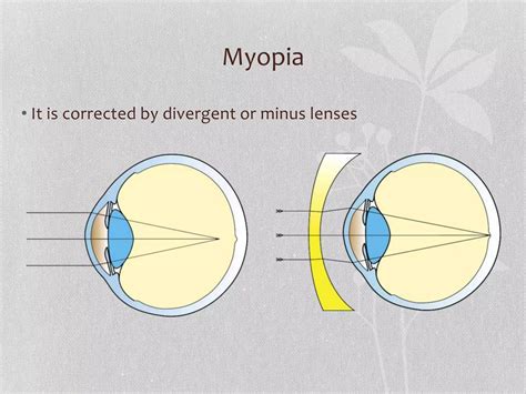 Visual Acuity And Its Disturbances Asik Ppt