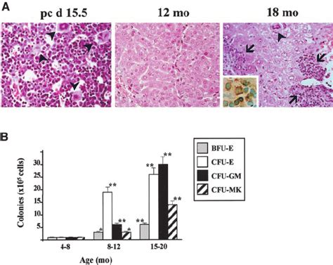 Liver As An Extramedullary Site Of Hematopoiesis In Old Gata 1 Low