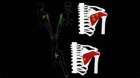 Myofascial Trigger Points Vector Art Stock Images Depositphotos