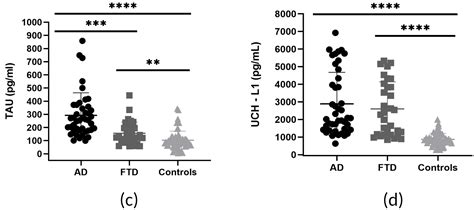 Simoa Diagnostics On Alzheimers Disease And Frontotemporal Dementia