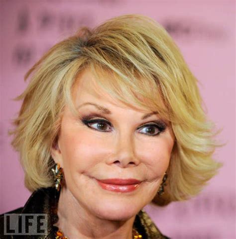 Celebrity Plastic Surgery Before And After 45 Pics