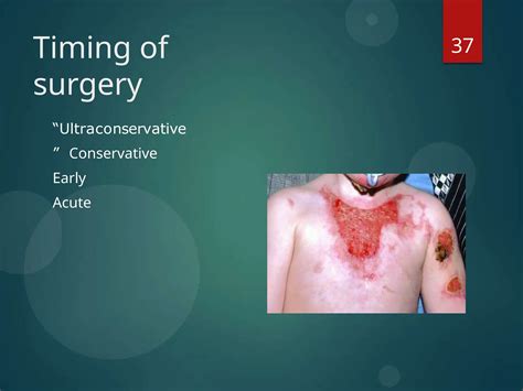 Burn History Physical Examination Of Burn And Pathophysiology Pptx