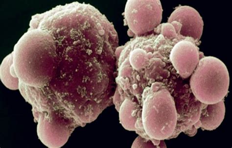 Neural Progenitor Cell Village Reveals Natural Variation Creative