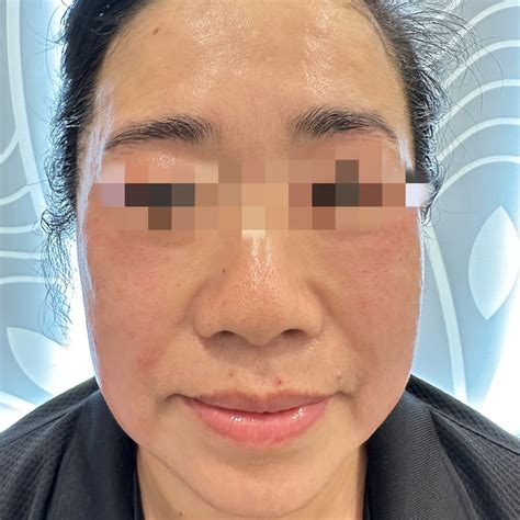 Lanree Aesthetics Laser Medical Beauty Clinic