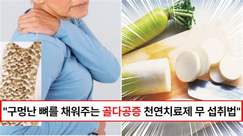 무 이렇게 먹었더니 구멍났던 뼈가 채워졌습니다” 뼈 건강에 탁월한 효능이 있는 무 섭취방법 나다뉴스