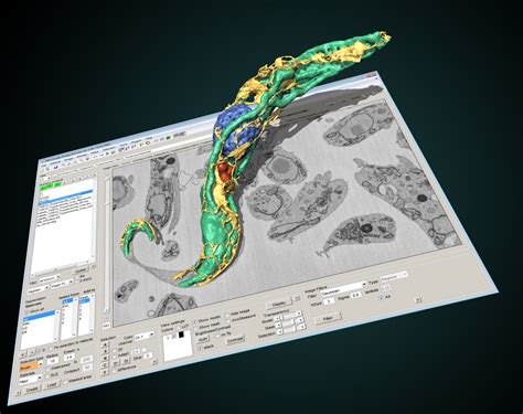 Microscopy Image Segmentation At Troy Musselman Blog