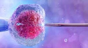 A Comprehensive Guide to IVF (In Vitro Fertilization)