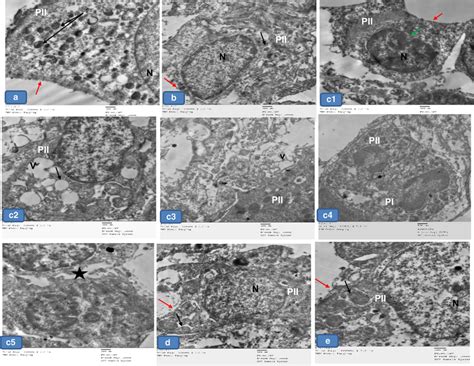 Representative Electron Micrographs Of Lung Tissue Of Adult Rats From