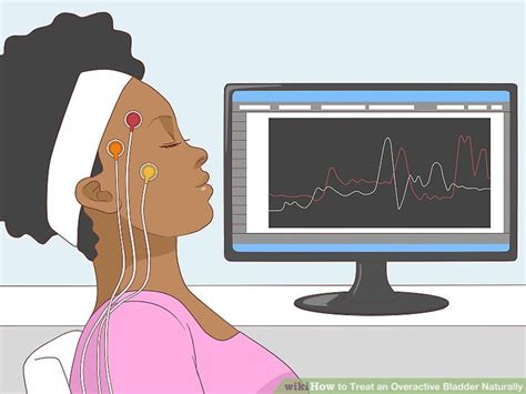 Ways To Treat An Overactive Bladder Naturally Wikihow Health