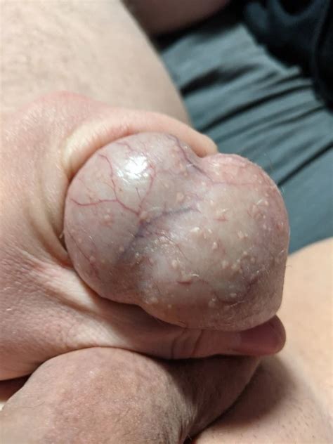 Ball Pictures 3 My Balls Hurting 20 Pics XHamster