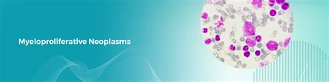 Myeloproliferative Neoplasms