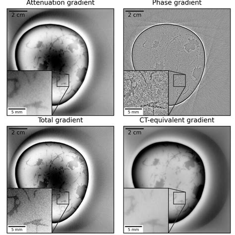 Gradient Denoising From Top To Bottom Noisy Gradients Denoised Download Scientific Diagram