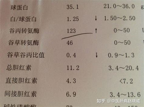 肝功检查结果怎样看一文带你了解详情 知乎