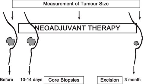 Example Of Research Protocol In Neoadjuvant Setting Treatment Is Given Download Scientific