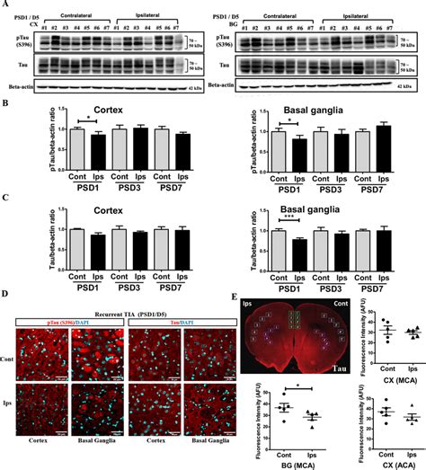 Recurrent Tia Induced Phospho Tau And Total Tau Alteration A
