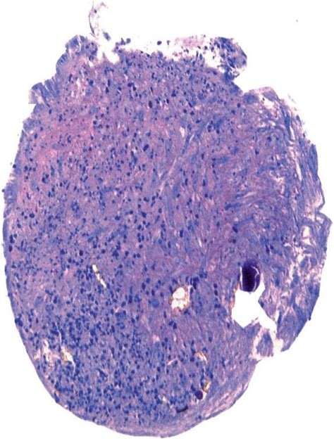 7 Msc Micromass Pellet Grown In Chondrogenic Medium And Stained With