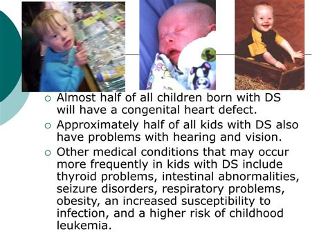 Ppt Birth Defects Powerpoint Presentation Free Download Id5425969