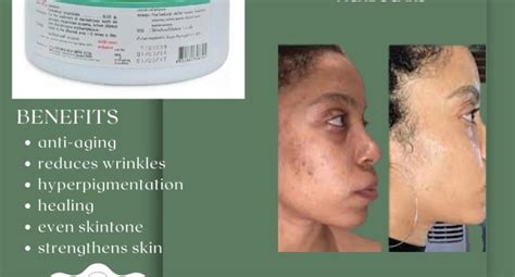 Clonovate Cream 450gms Olscoke