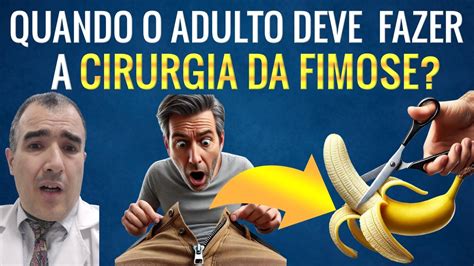 Quando o adulto deve fazer a CIRURGIA DE FIMOSE? - YouTube