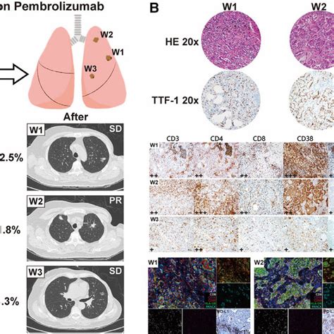 Wen Zhao Zhong Research Director Doctor Of Medicine Guangdong Academy Of Medical Sciences