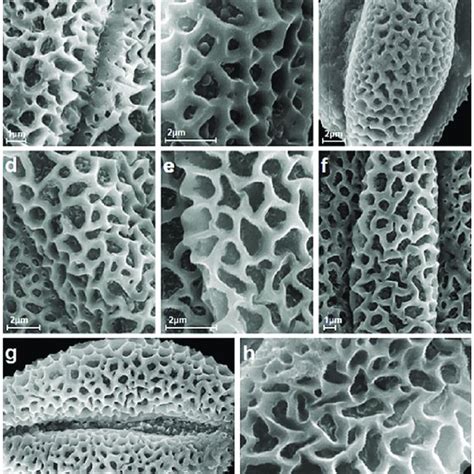 Reticulate Exine Ornamentation From Types 1 And 2 With Lumen Muri And