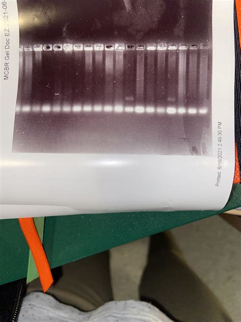 Genotyping APP PSEN Mice And WT With PCR And Gel Electrophoresis What Are Some Things That