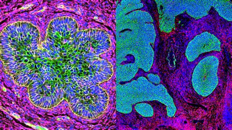 The 2023 Spatial Biology Image Contest Winners Present Their Results
