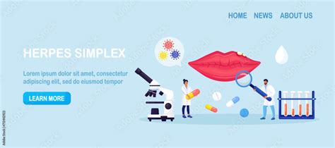 Herpes Simplex Virus On Human Lips Dermatological Disease With Watery