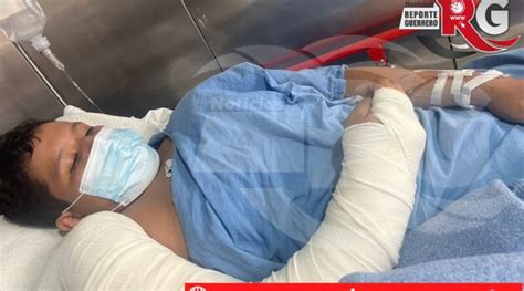 Por negligencia médicos del ISSSTE pretenden amputar brazo a menor de